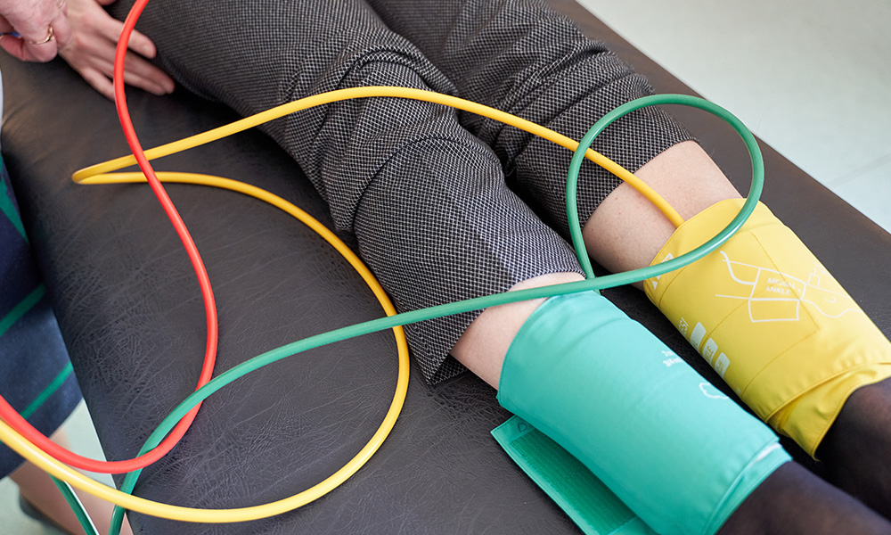 Peripheral Artery Disease Symptoms & Treatments | CVM Cardiology