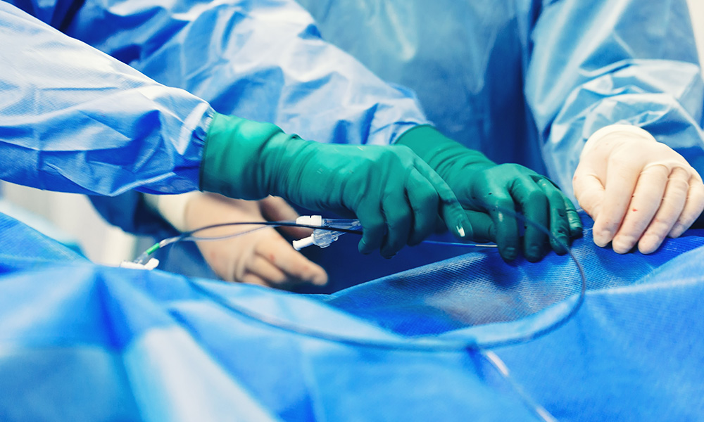 Non-Surgical Closure of Patient Foramen Ovale in Patients with a Stroke